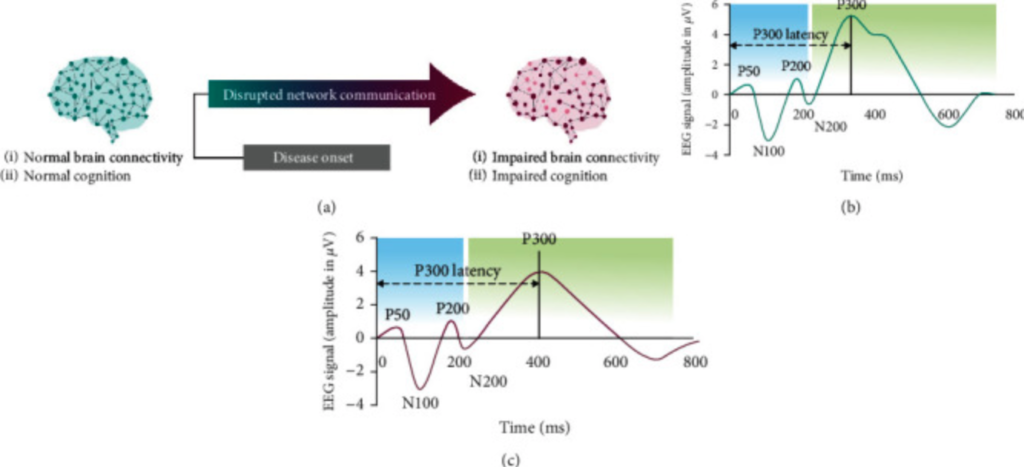 The benefits of collecting EEG neuroimaging insights in clinical trials ...